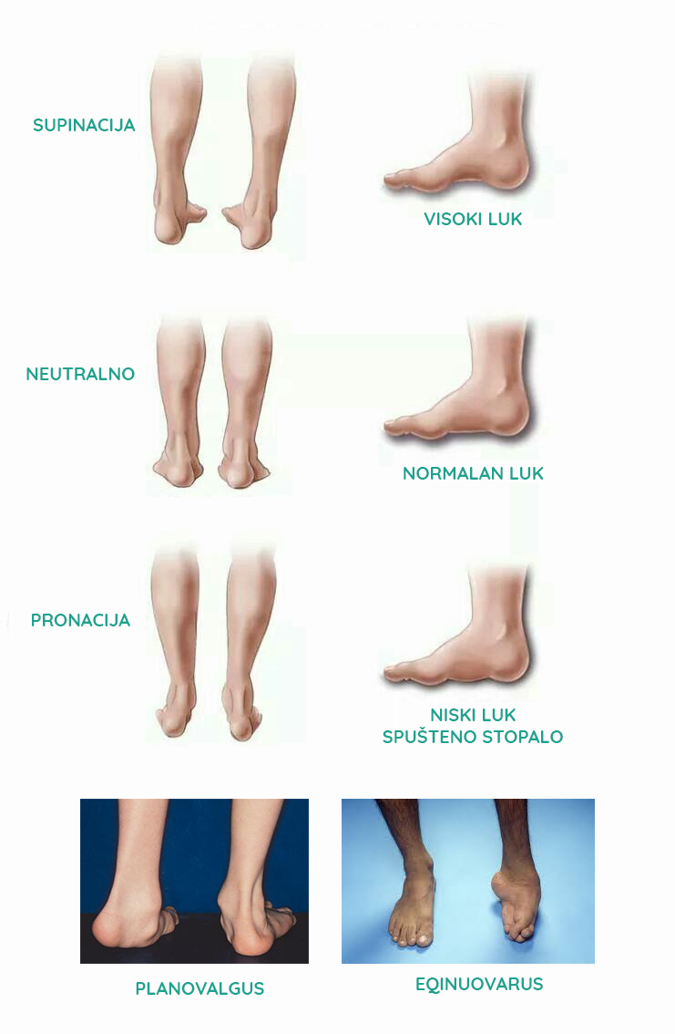 Bol u ahilovoj tetivi (Ne budite ranjivi kao Ahil) - Poliklinika ...